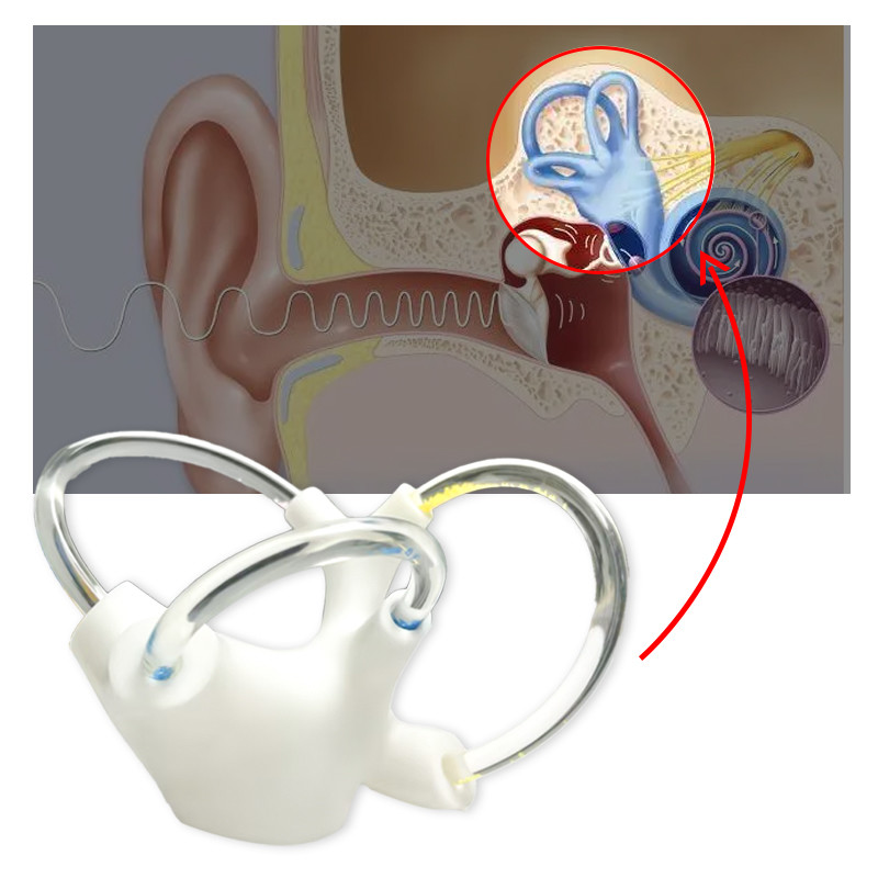 Human Skeleton Cochlea Inner Ear Cranial Nerve Rehabilitation ...